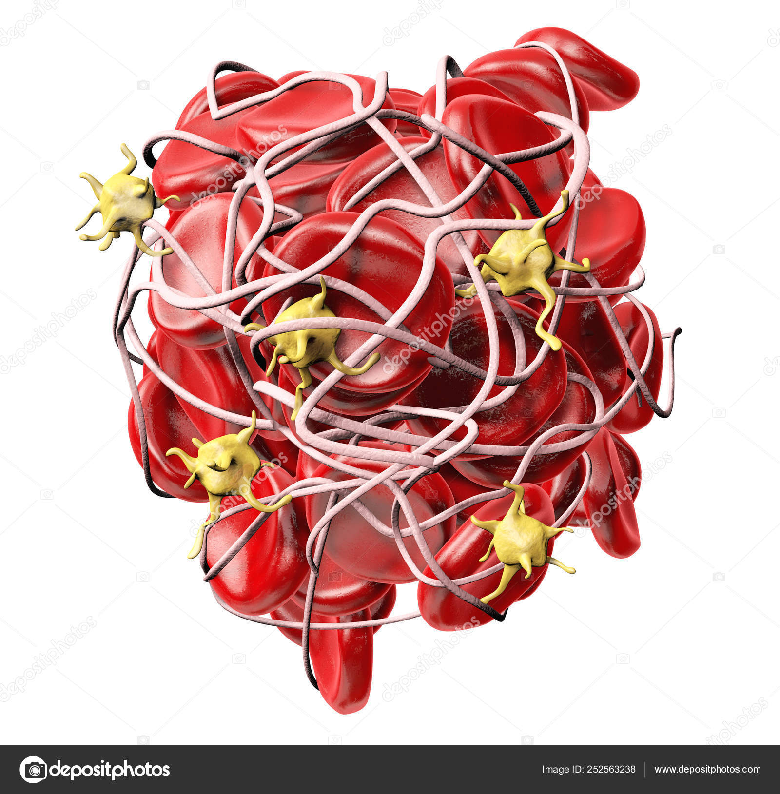 Fibrin Blood Clot