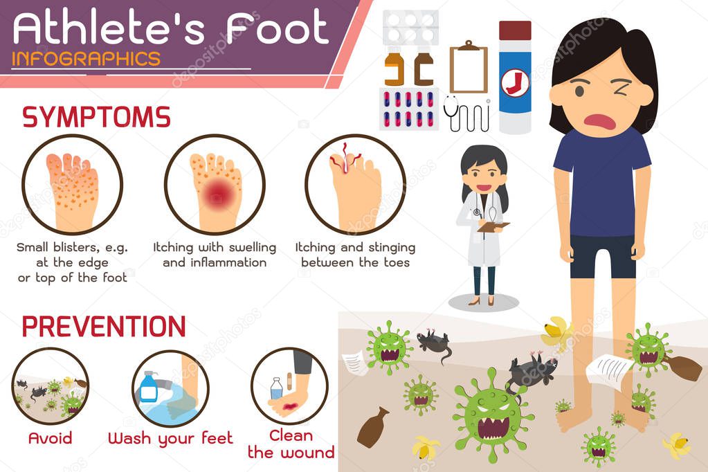 Infografías de la enfermedad de pie o pie de Hong kong del atleta ...
