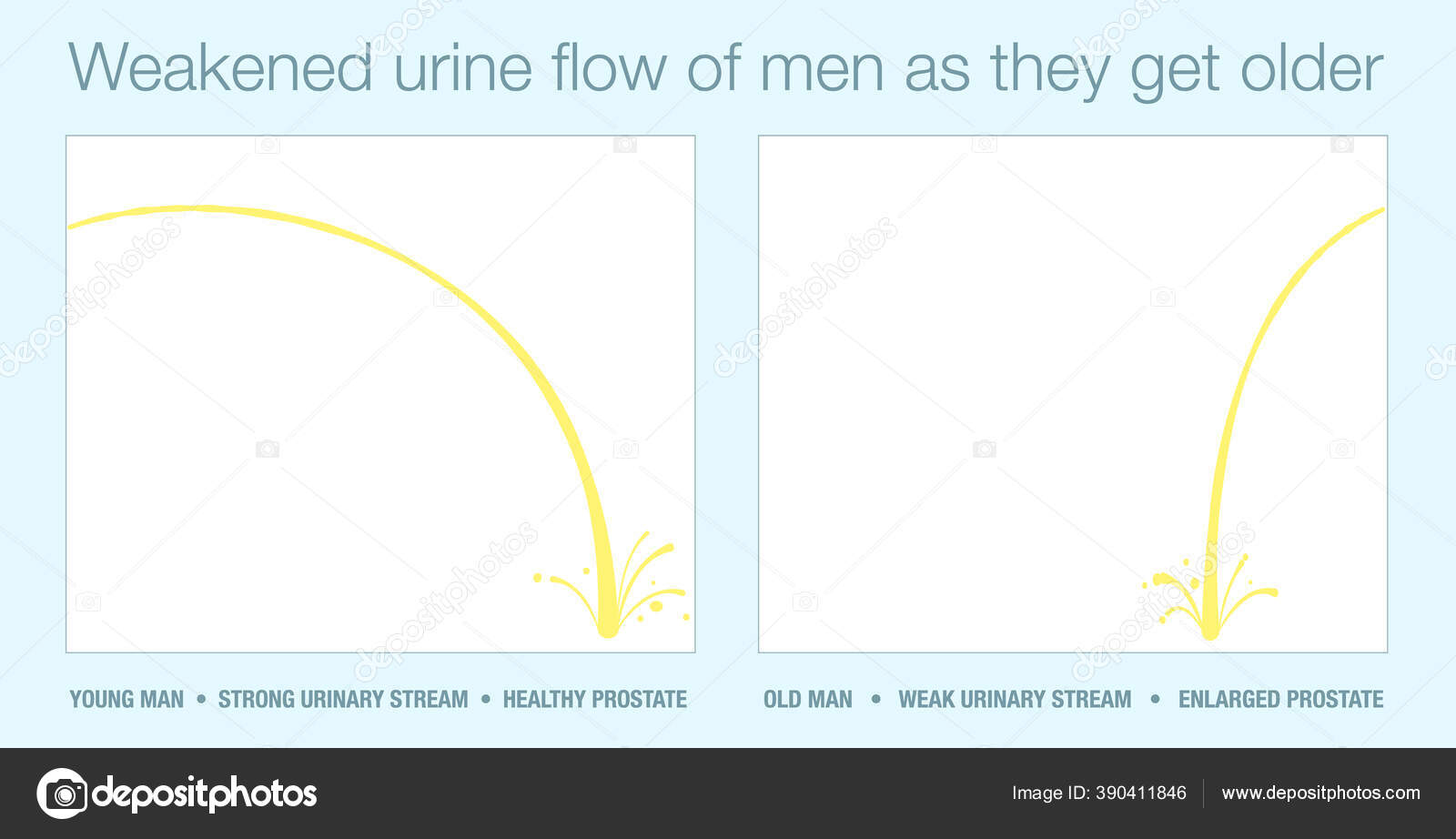 Corkscrew Urine Stream at Zane Hodge blog