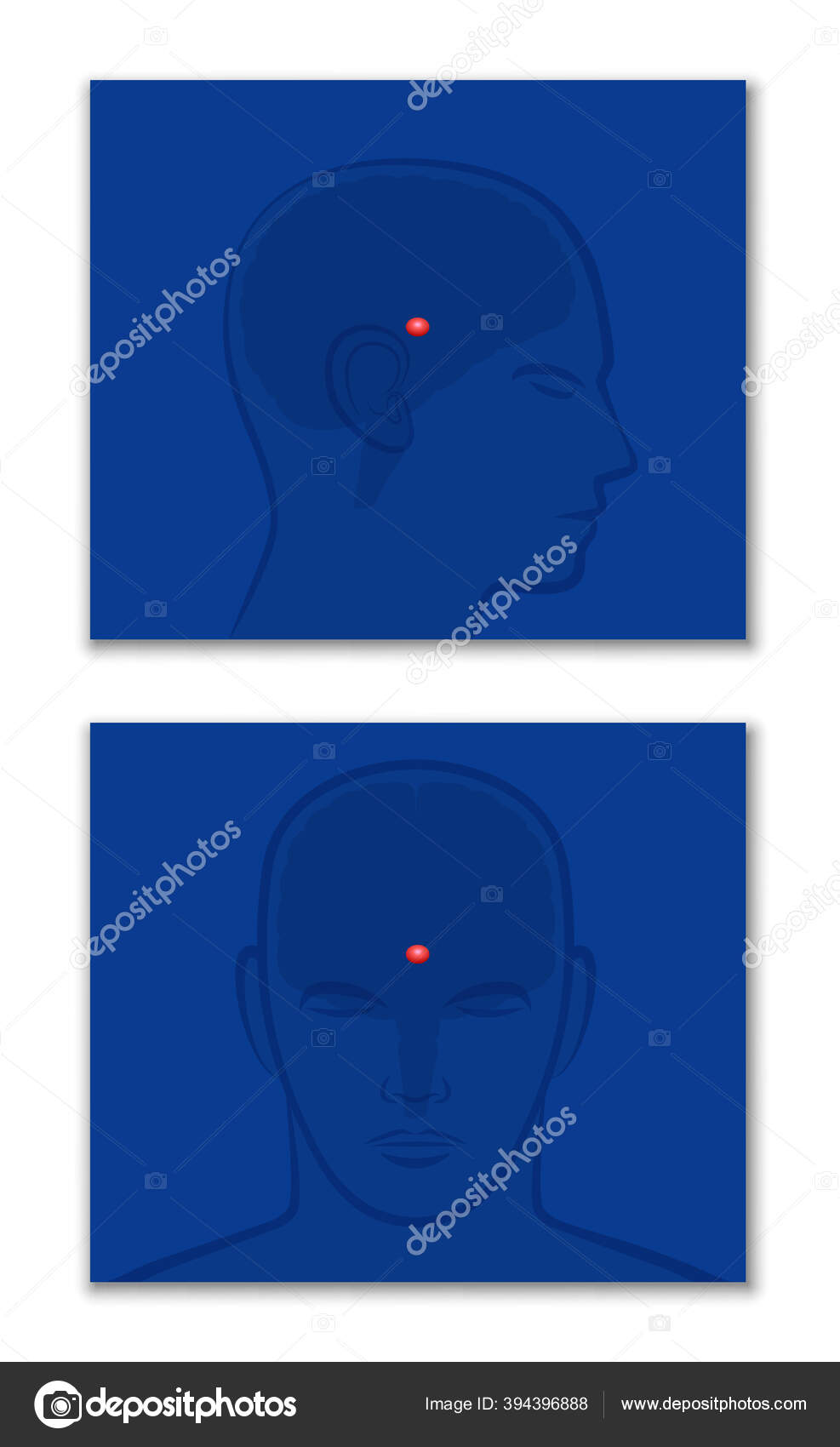 Glândula Pineal Epífise Cerebral Terceiro Olho Perfil Vista Frontal Com ...