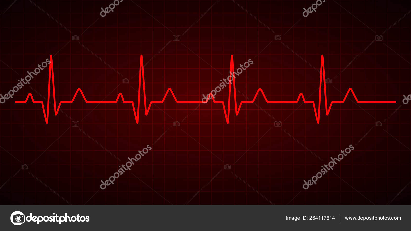 Heartbeat line. Cardiogram. Electrocardiogram. Vector illustration ...