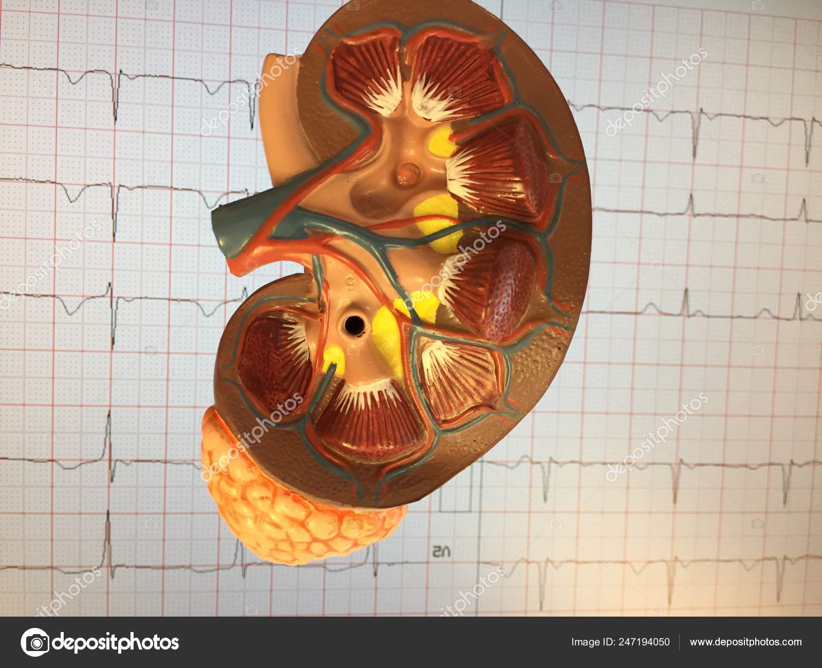 Anatomical Plastic Model Human Kidney Showing Circulation Functional ...
