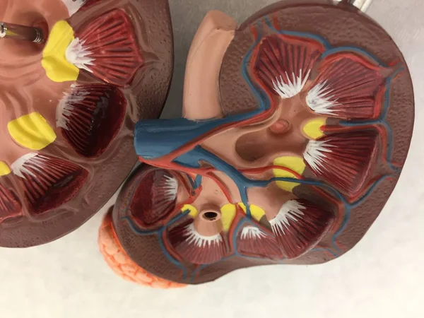 Fotos de Transplante de rim, Imagens de Transplante de rim sem ...