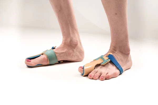 Stabilizing orthosis for the correction of the big toe on the white ...