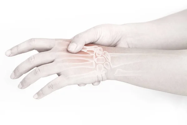 Hand Bone Pain White Background Hand Injury Stock Photo by ©horsoftacc ...