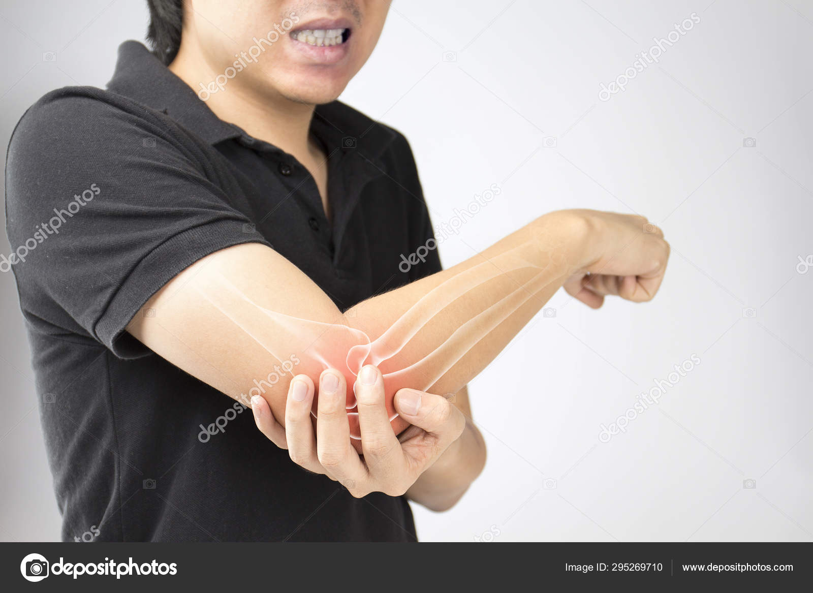 Elbow Bones Injury White Background Elbow Pain Stock Photo by ...