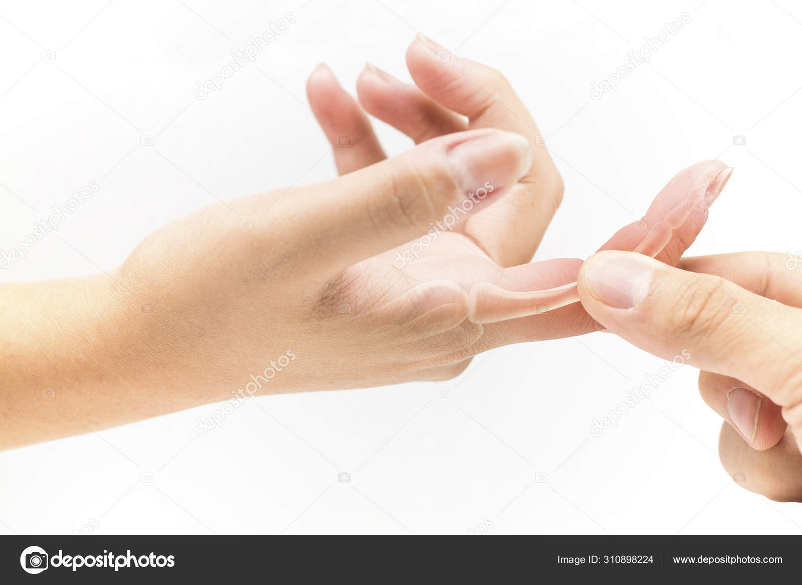 Finger Bone Pain White Background Finger Injury Stock Photo by ...