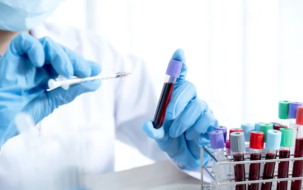 Blood testing laboratory Stock Photos, Royalty Free Blood testing ...