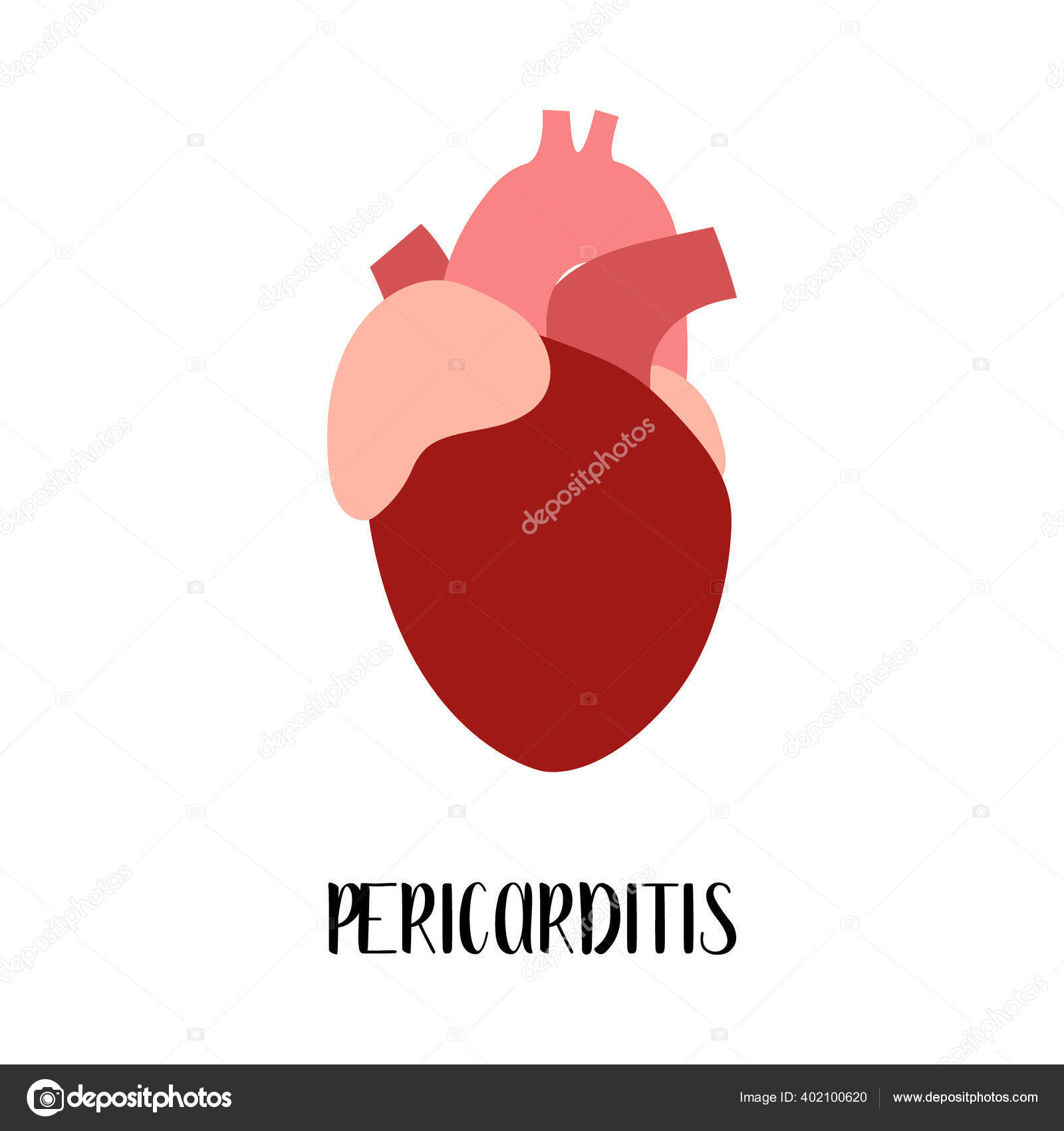 Pericarditis Corazón Enfermedades Cardiovasculares Cardiología ...