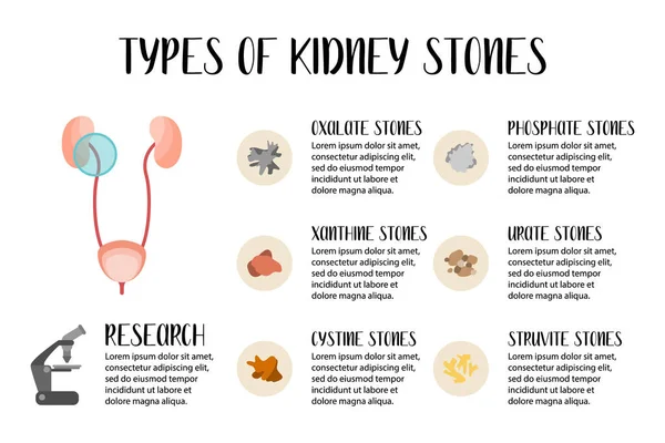 Bristol stool chart with excrement description and types outline ...