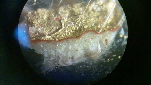 Coronary plaque Stock Photos, Royalty Free Coronary plaque Images ...