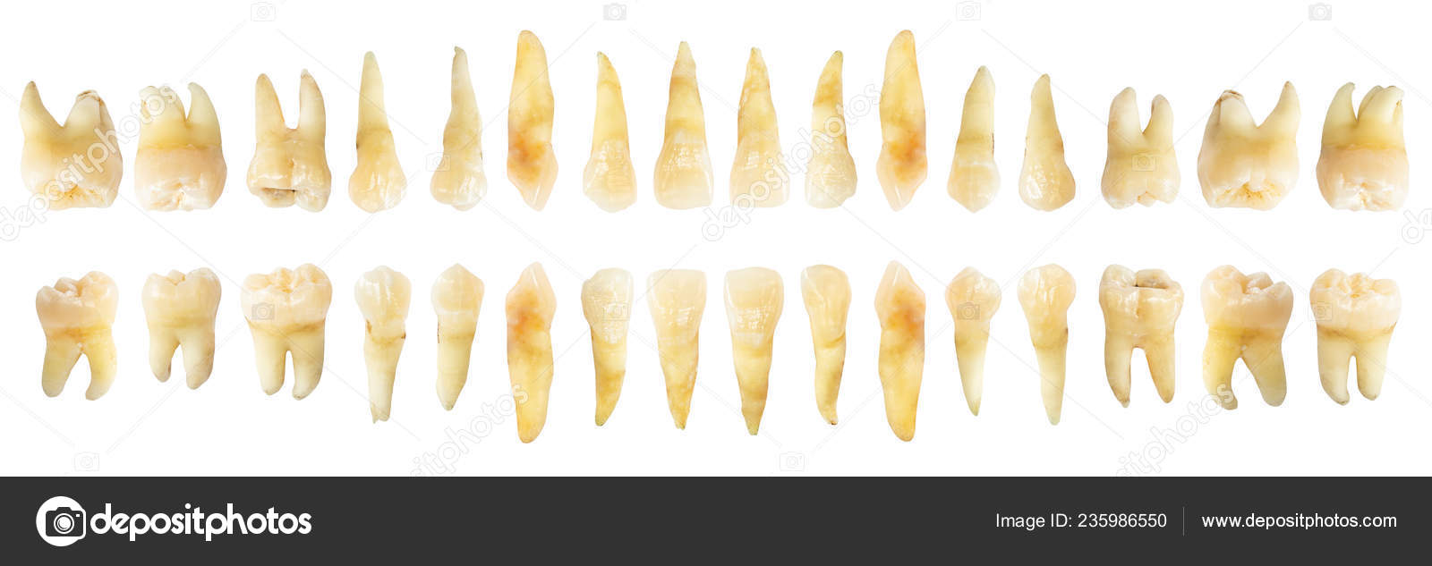 Tooth Diagram Photography Real Teeth Chart Front Horizontal View ...