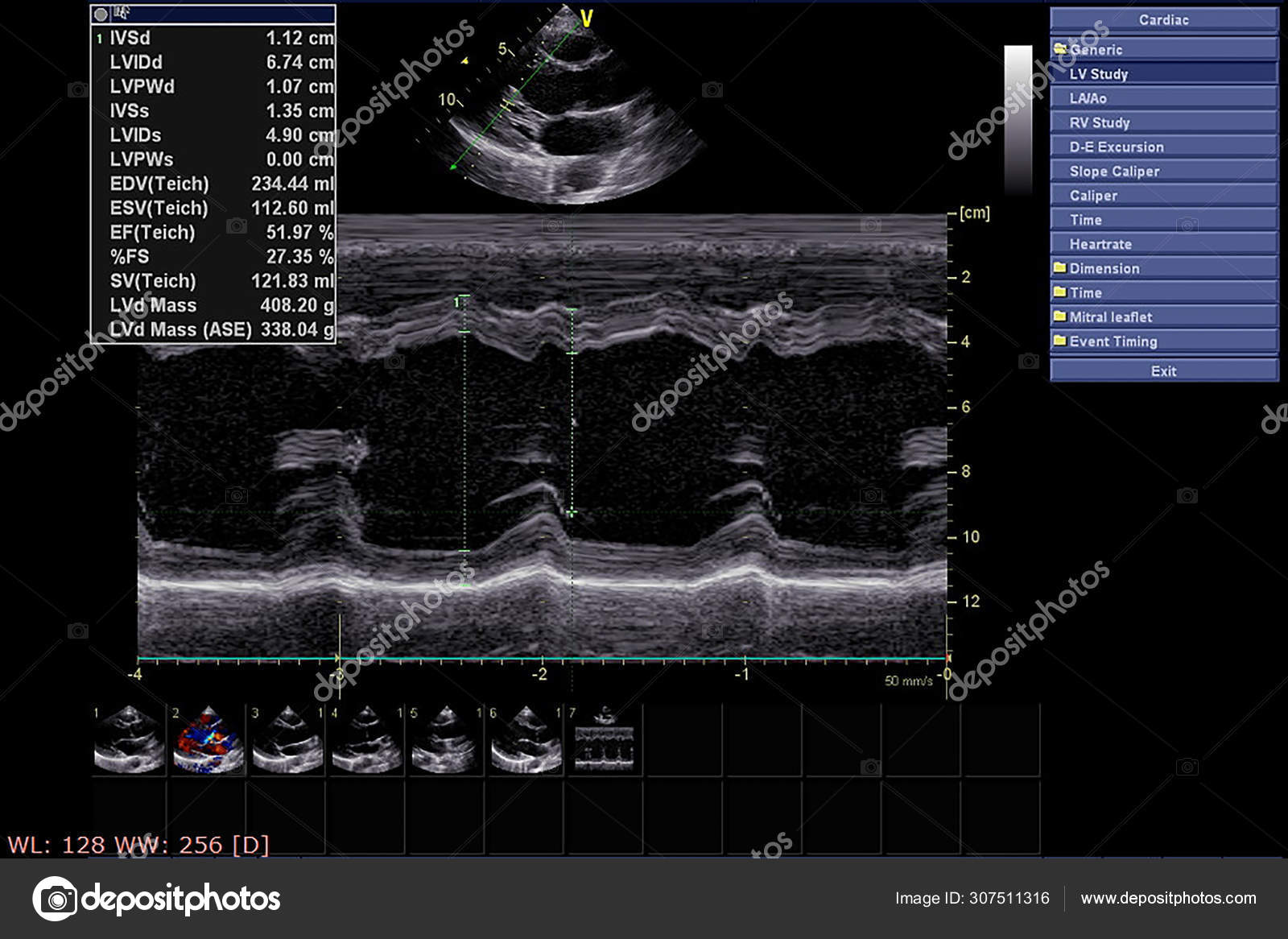 Screen of echocardiography (ultrasound) machine. — Stock Photo ...