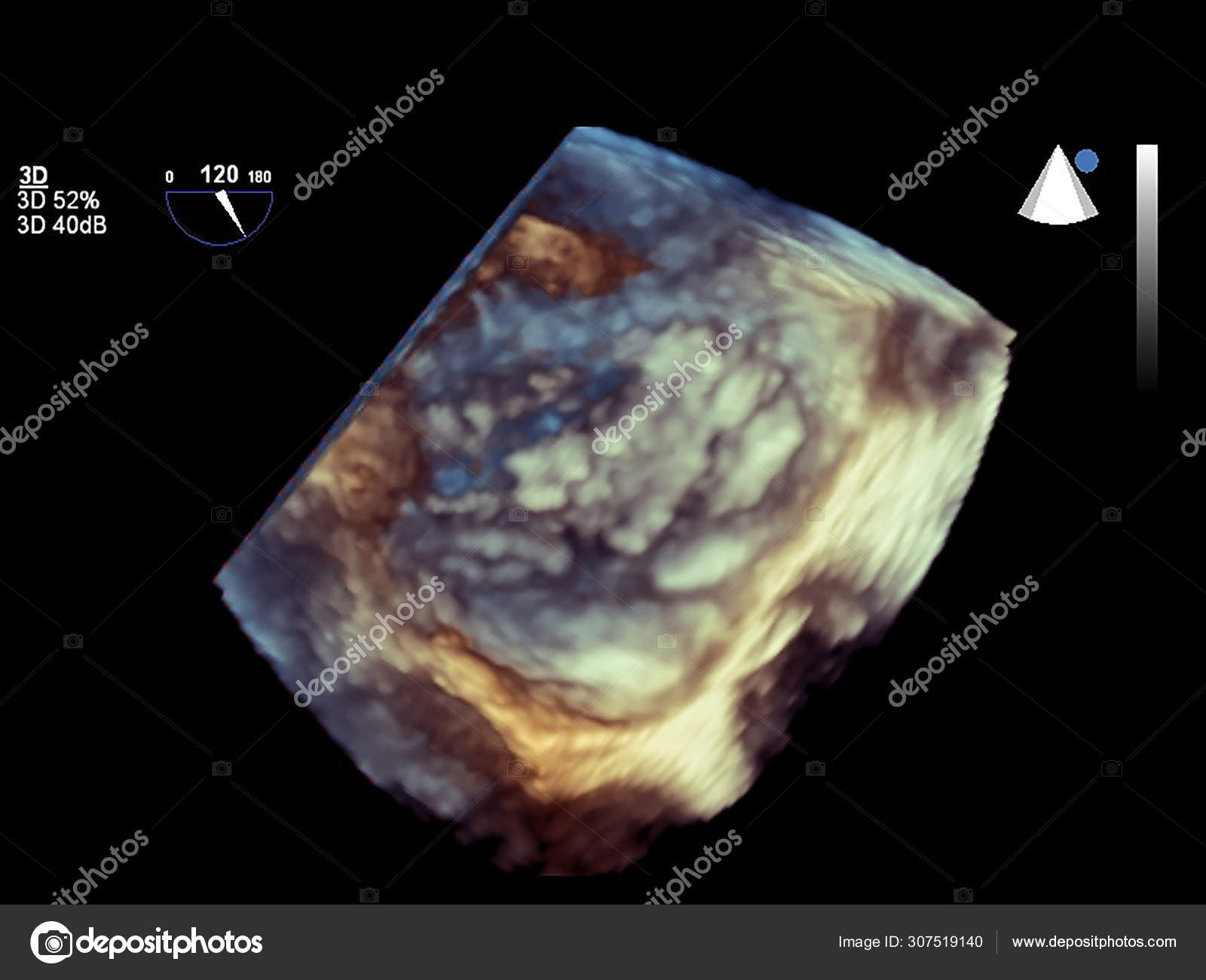 Modern 3D echocardiography. Stock Photo by ©Faustasyan 307519140