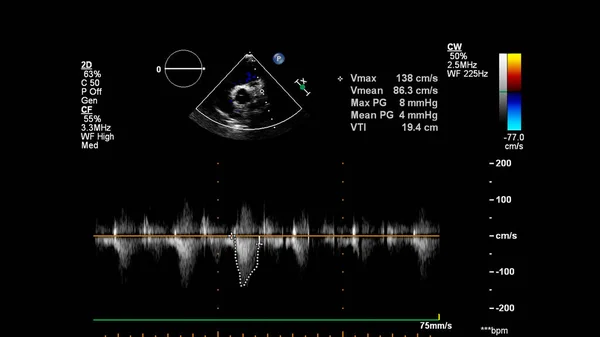 Doppler scan Stock Photos, Royalty Free Doppler scan Images | Depositphotos