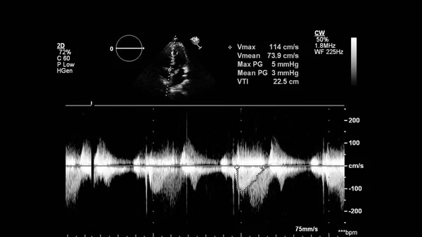 Doppler scan Stock Photos, Royalty Free Doppler scan Images | Depositphotos