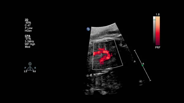 Ultrasound of the pelvis Stockfotos, lizenzfreie Ultrasound of the ...