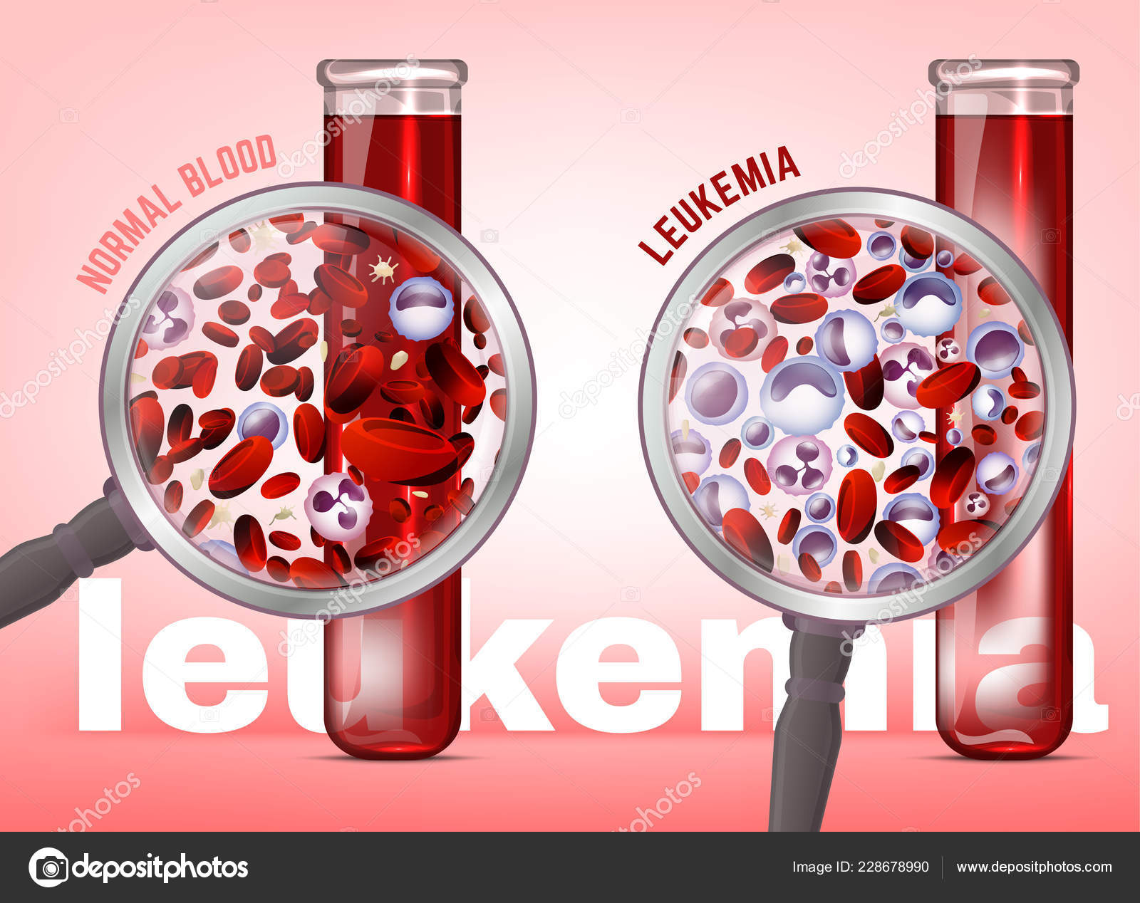 Leucemia fondo horizontal vector, gráfico vectorial © annyart imagen ...