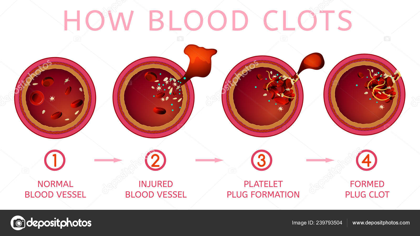 Proceso de coagulación sanguínea vector, gráfico vectorial © annyart imagen #239793504