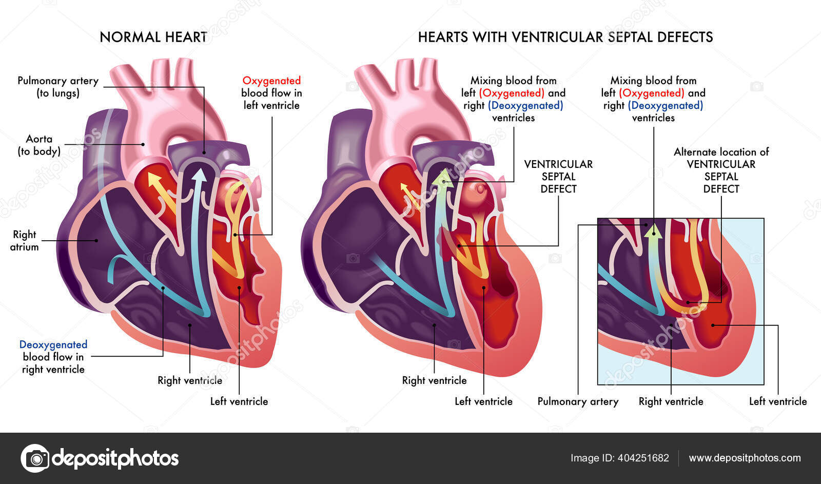 Normal Heart Circulation Diagram Pin On College/ Nursing