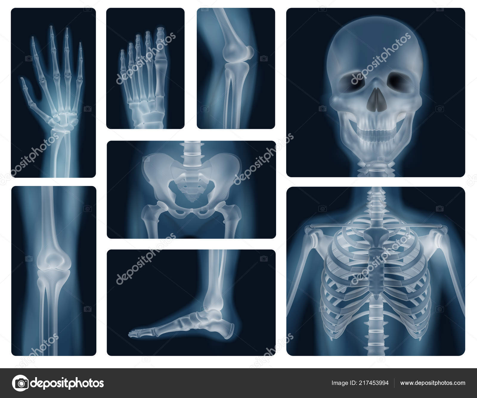 Human Bones Realistic X-ray Shots Stock Vector Image by ©macrovector ...