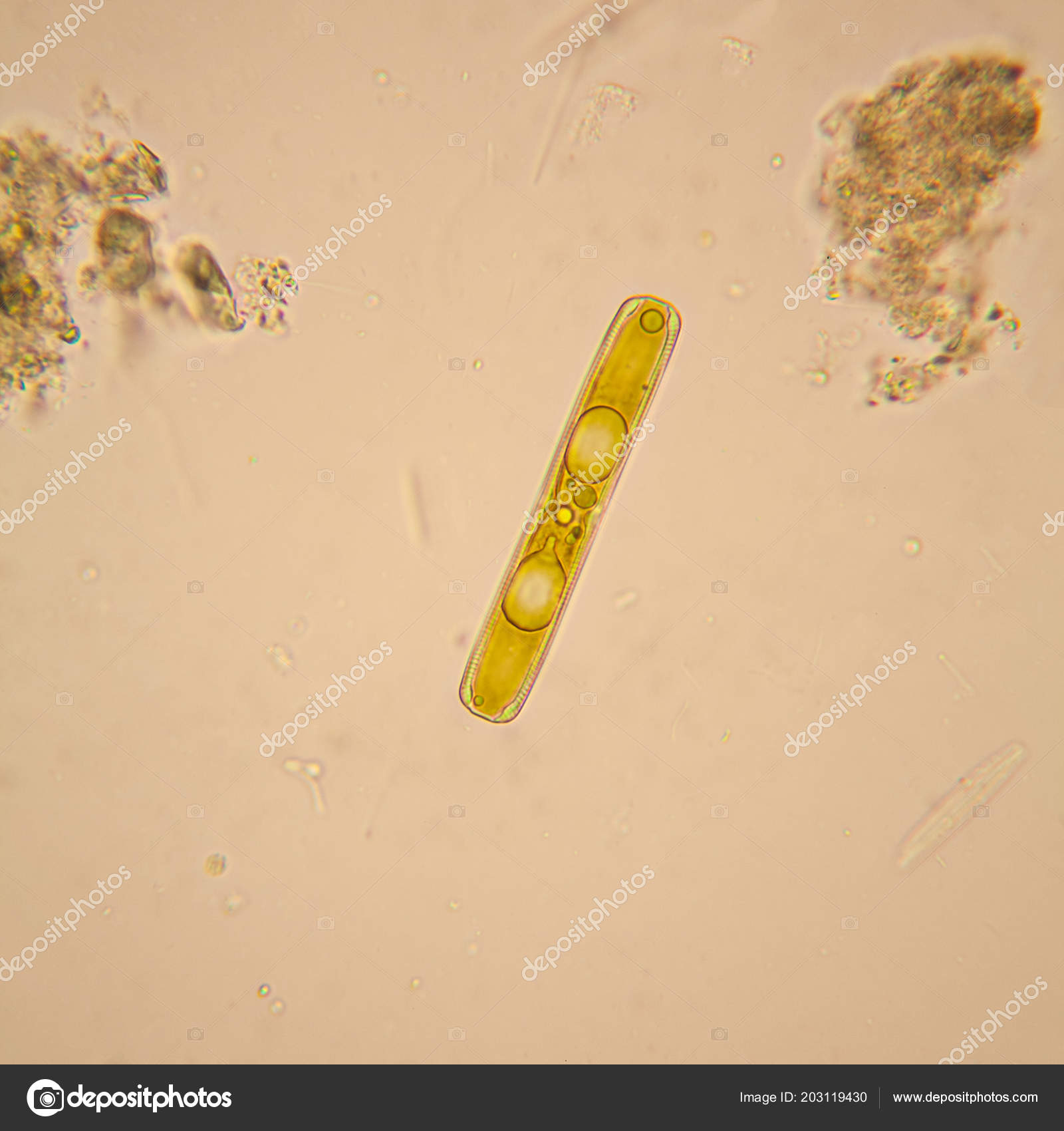 Bacteria In Pond Water