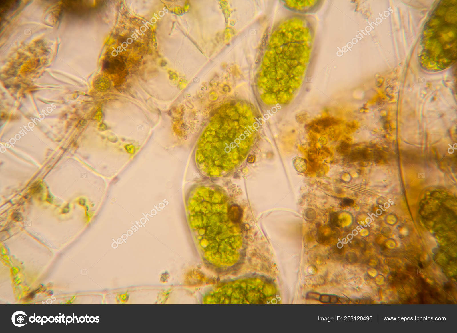 Spirogyra Under Microscope 100x