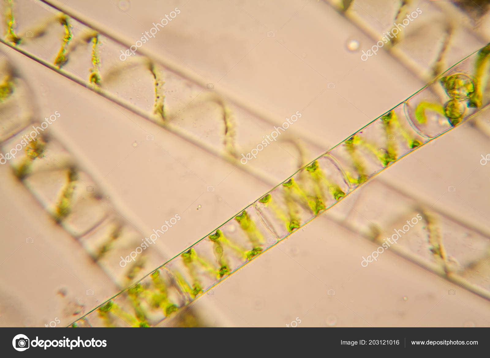 Spirogyra Under Microscope