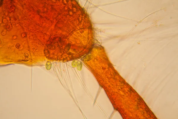 Fresh Pond Water Plankton Algae Microscope Pond Mite Stock Photo by ...
