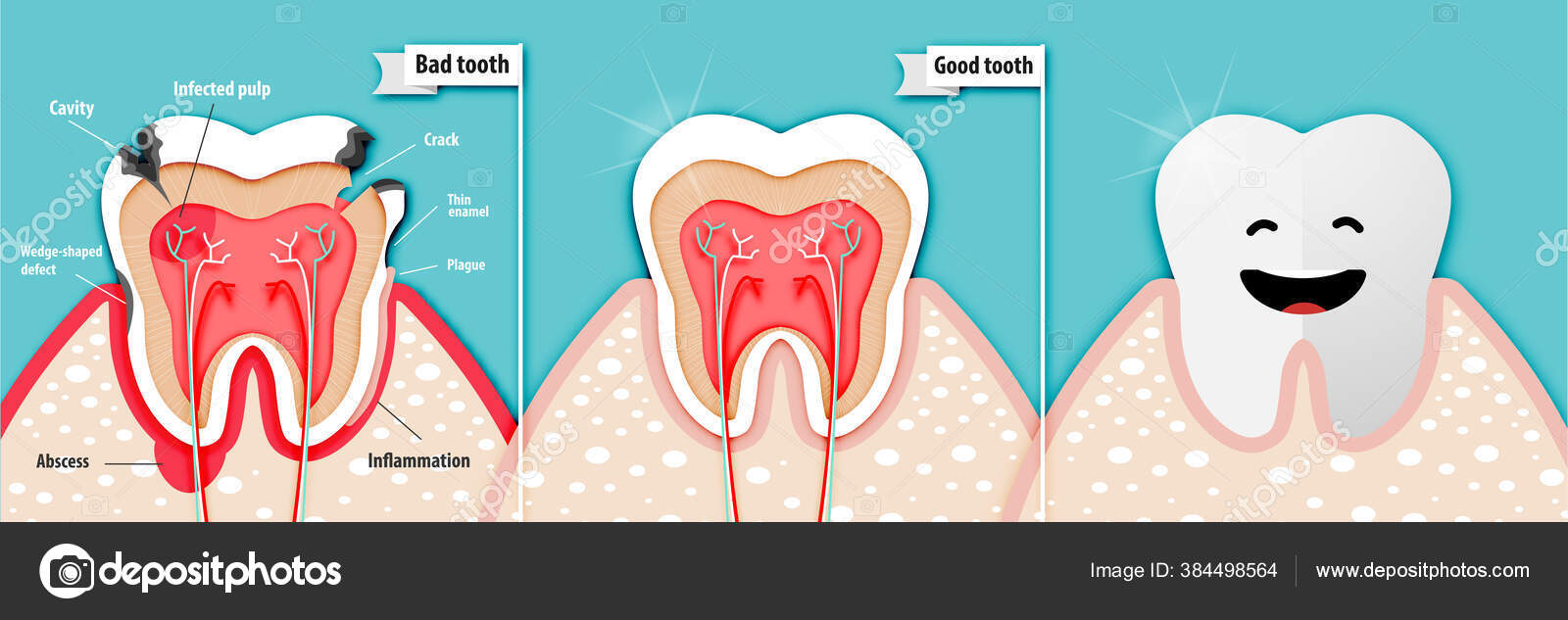 Paper Art Health Science Bad Tooth Good Tooth Vector Stock Vector by ...
