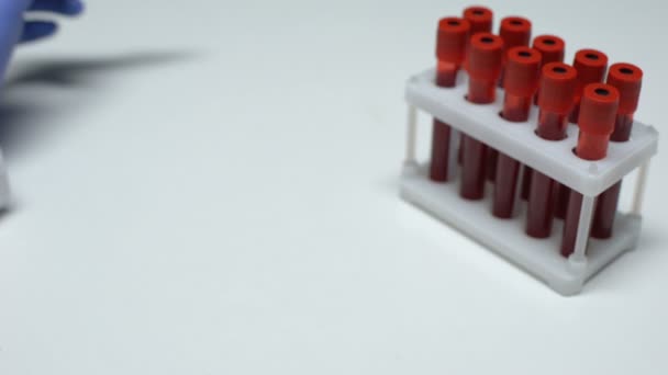 176 Toxic metals Videos, Royalty-free Stock Toxic metals Footage ...