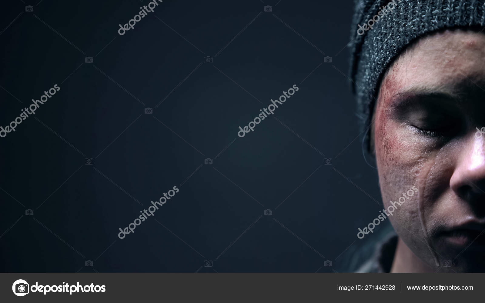 Half Face Crying Violence Victim Closeup Homelessness Despair Social ...