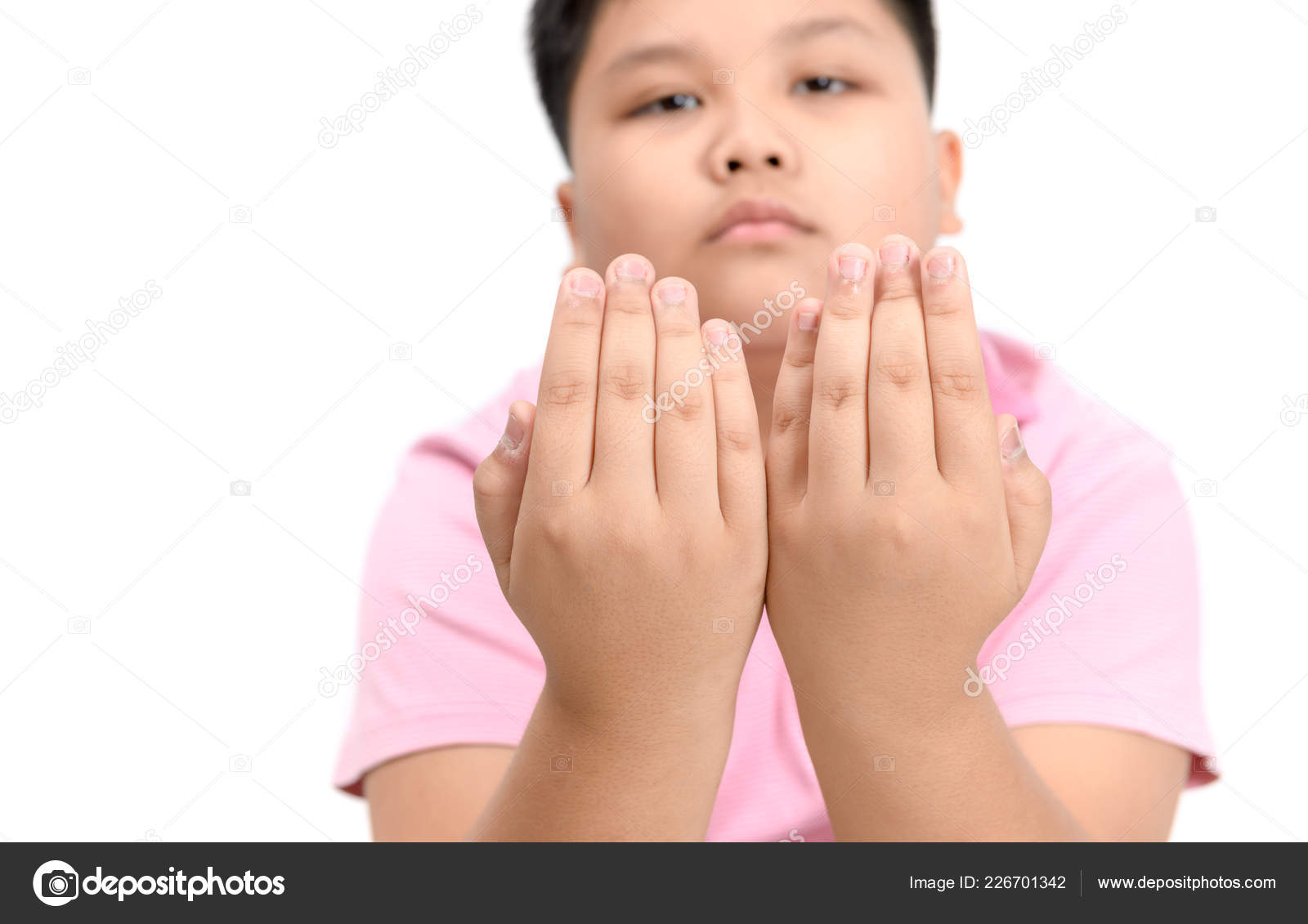 Disgusting Bitten Fingernails Boy's Hand Isolated White Background ...