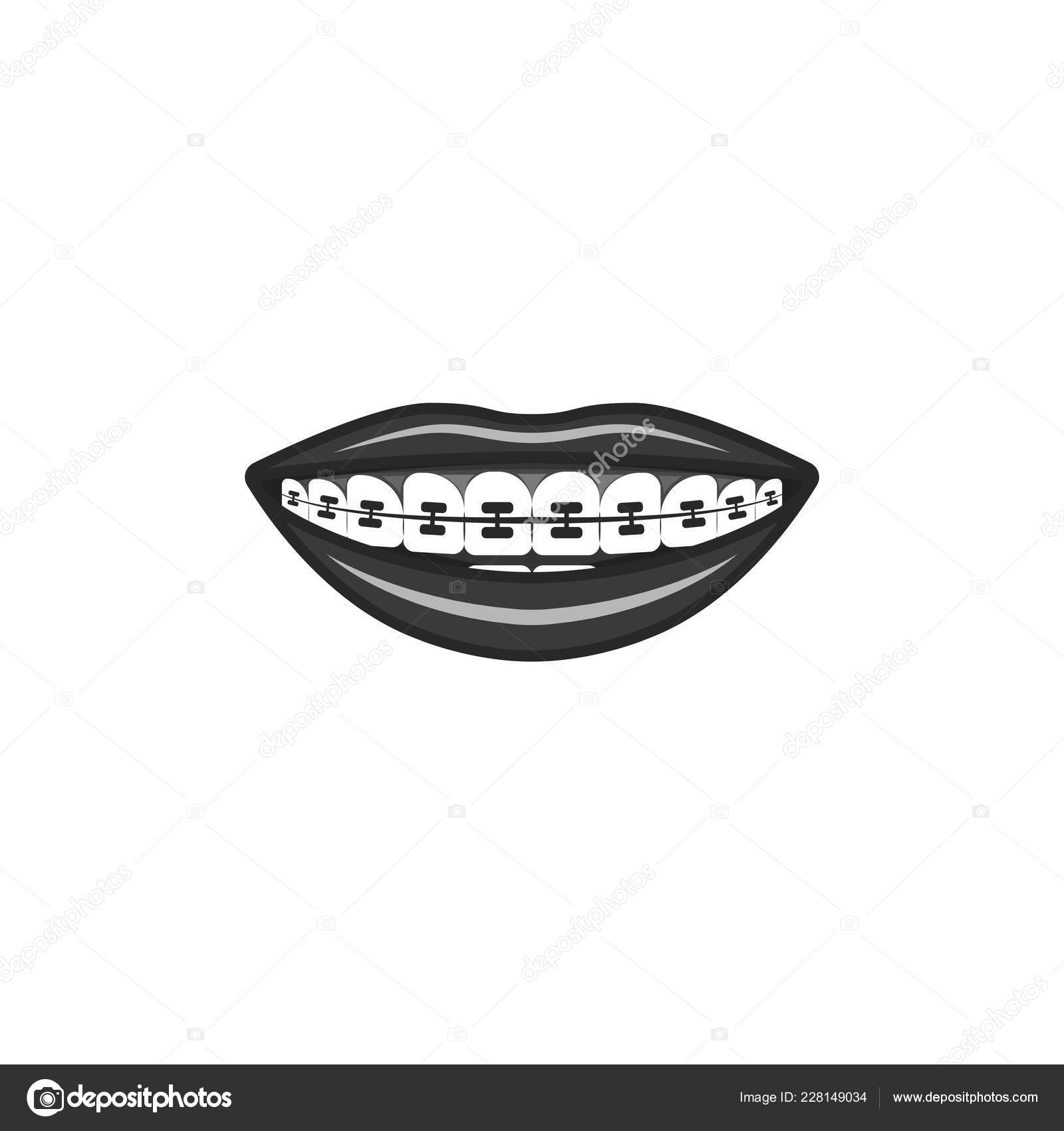 Smile With Braces Drawing