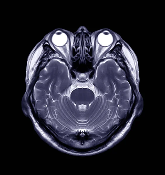 Face mri Stock Photos, Royalty Free Face mri Images | Depositphotos