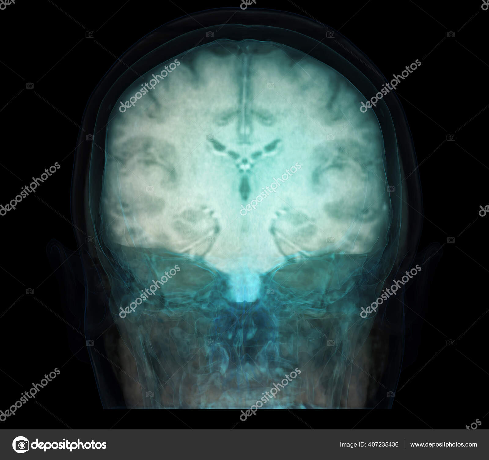Transparent Image Skull Blue Color Brain Medical Background Concept ...