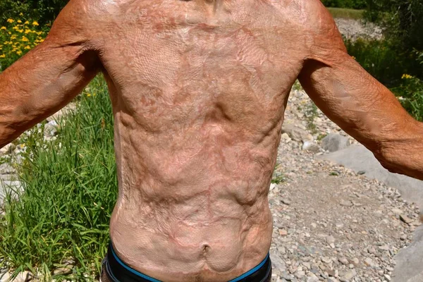 Electrocute Stock Photos, Royalty Free Electrocute Images | DepositPhotos