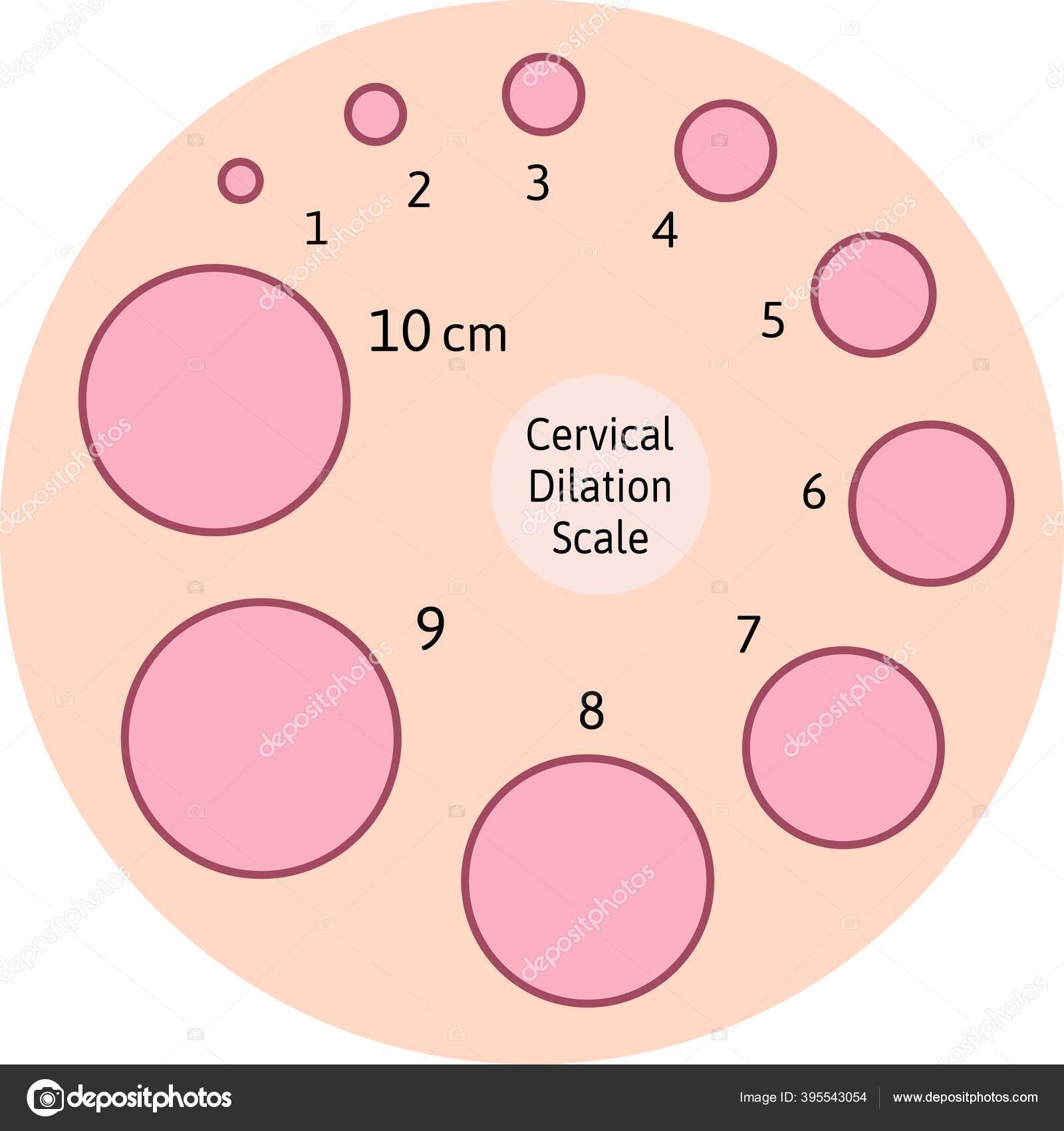 Dilated Cervix Diagram