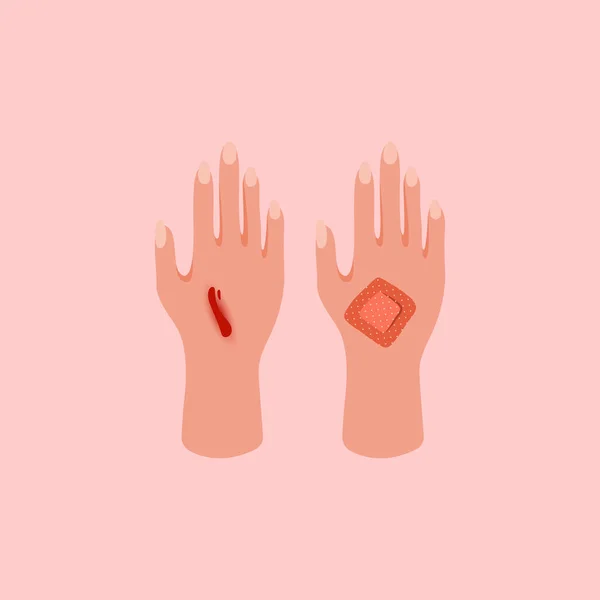 ᐈ Cartoon bruises stock vectors, Royalty Free bruises illustrations ...