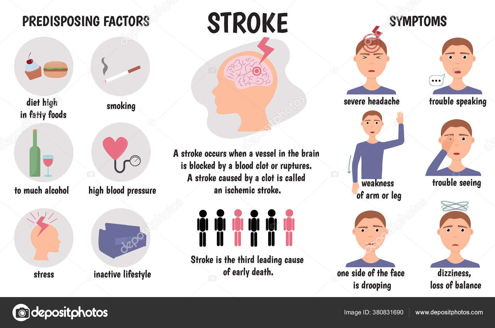 Ischemic Stroke Symptoms