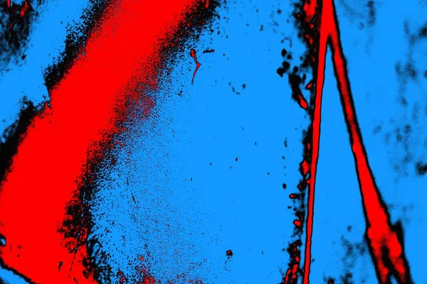 Blue tonsils Stock Photos, Royalty Free Blue tonsils Images | Depositphotos