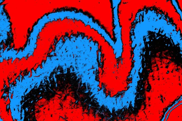 Blue tonsils Stock Photos, Royalty Free Blue tonsils Images | Depositphotos