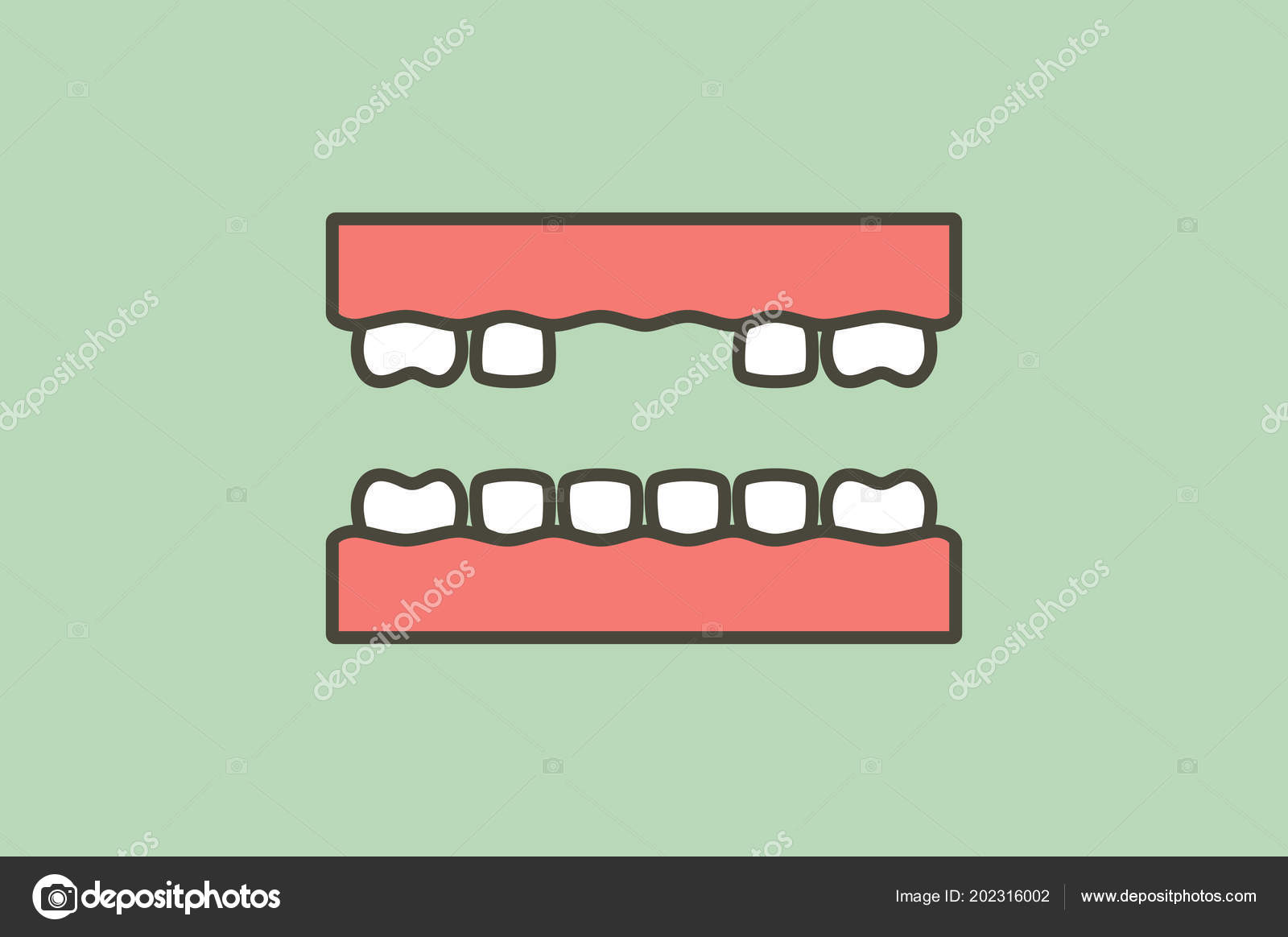 Missing Tooth Space Teeth Dental Cartoon Vector Flat Style Cute Stock ...