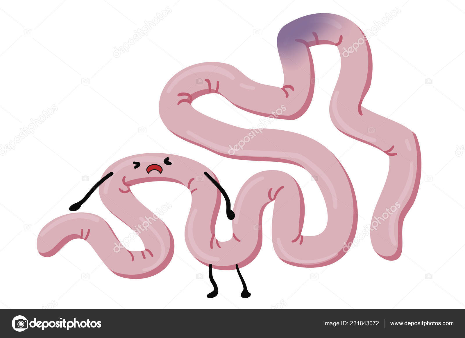 Small Intestine Bowel Obstruction Illustration Stock Illustration by ...