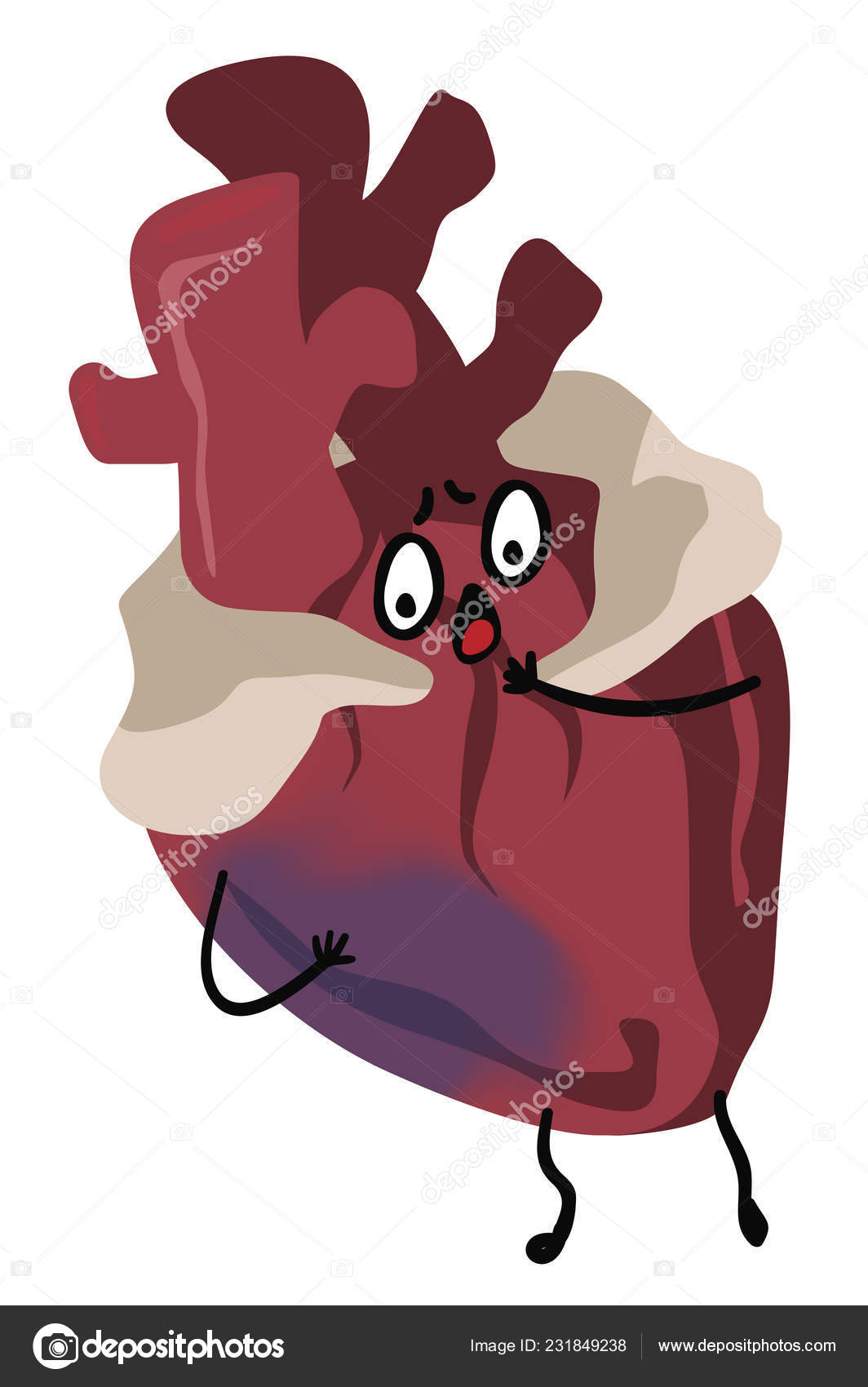 Human Heart Myocardial Infarction Cartoon Illustration Stock ...