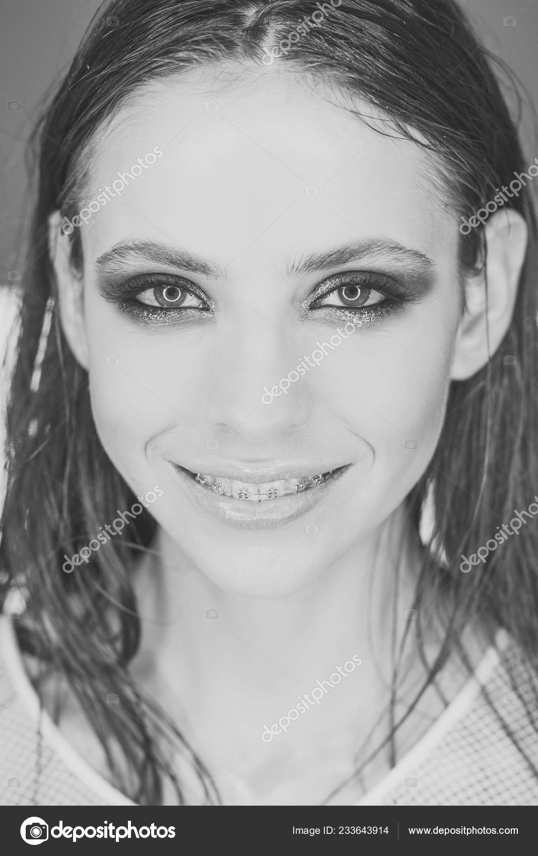 Woman with braces on teeth. Happy girl smile with dental braces. Woman ...