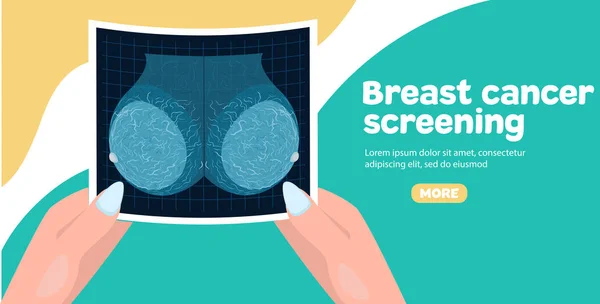 618 Breast cancer screening Vectors - Free & Royalty-free Breast cancer ...