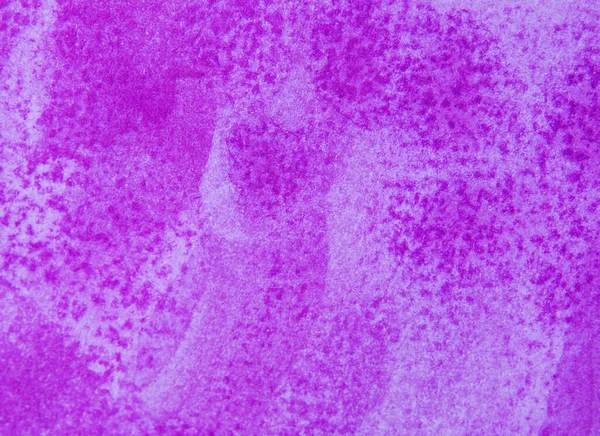 Jaringan ikat longgar Stock Photos, Royalty Free Jaringan ikat longgar ...