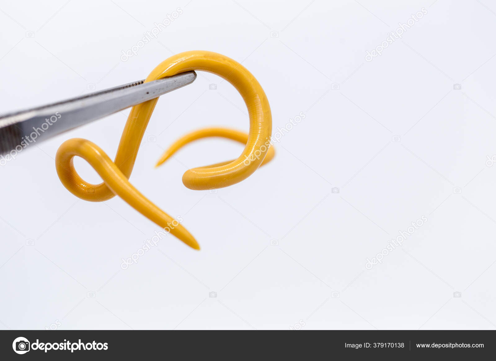 Ascaríase Uma Doença Causada Pelo Parasita Lombricoides Ascaris Para ...