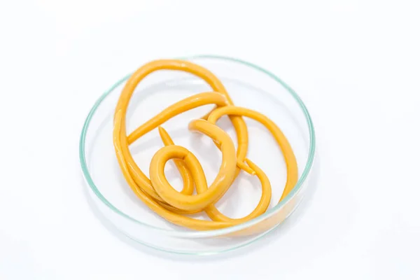 Ascaríase Uma Doença Causada Pelo Parasita Lombricoides Ascaris Para ...